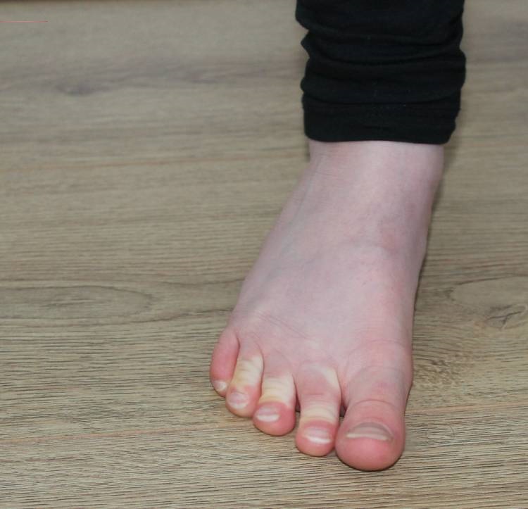 Foot and Ankle Exercises - Keeping Me Well