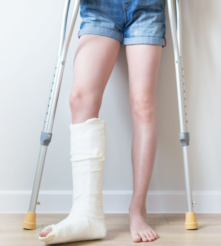 Leg Fractures - Keeping Me Well