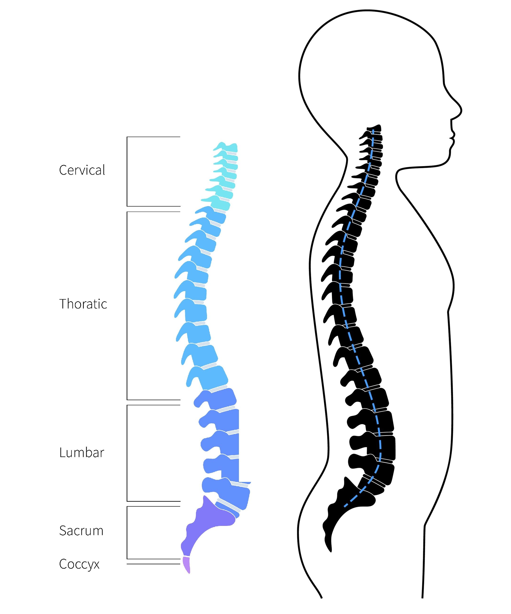 Back and Neck Pain in Children - Keeping Me Well
