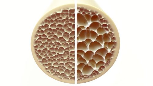 Children's Physiotherapy for Metabolic Bone Conditions - Keeping Me Well