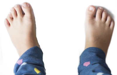 Out-Toeing - Keeping Me Well